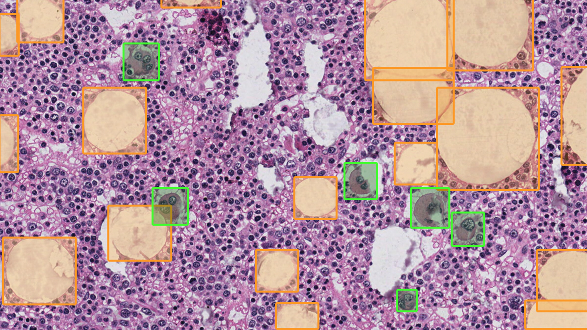 KML vision: Grazer Startup lässt Künstliche Intelligenz Laborbilder ...