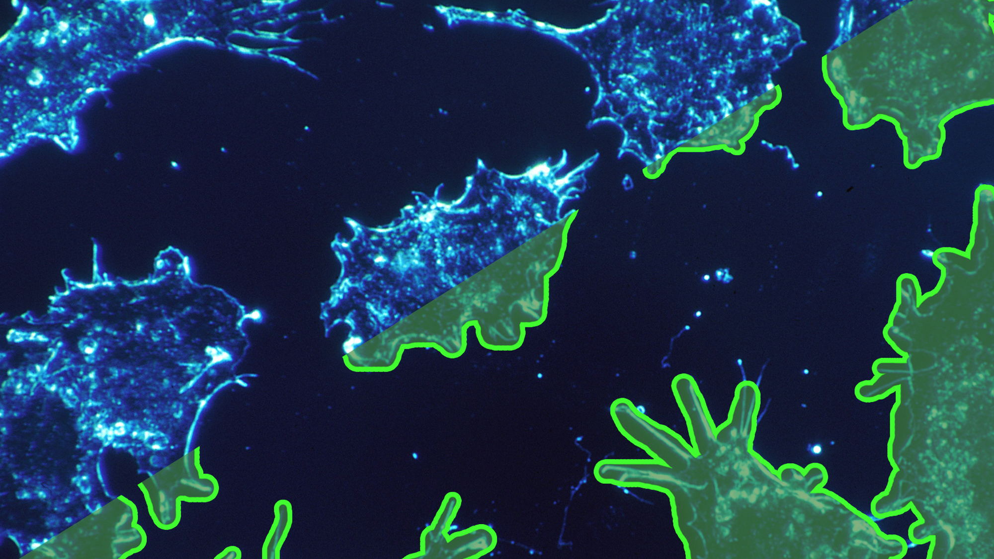 KML vision: Grazer Startup lässt Künstliche Intelligenz Laborbilder ...