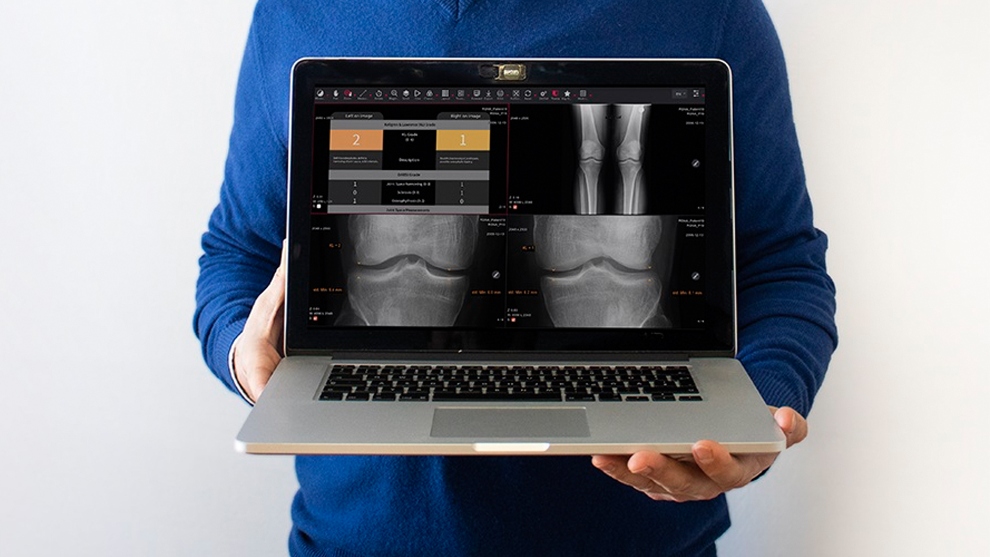 ImageBiopsy Lab: Millionensumme für das Health-AI-Startup, das ...