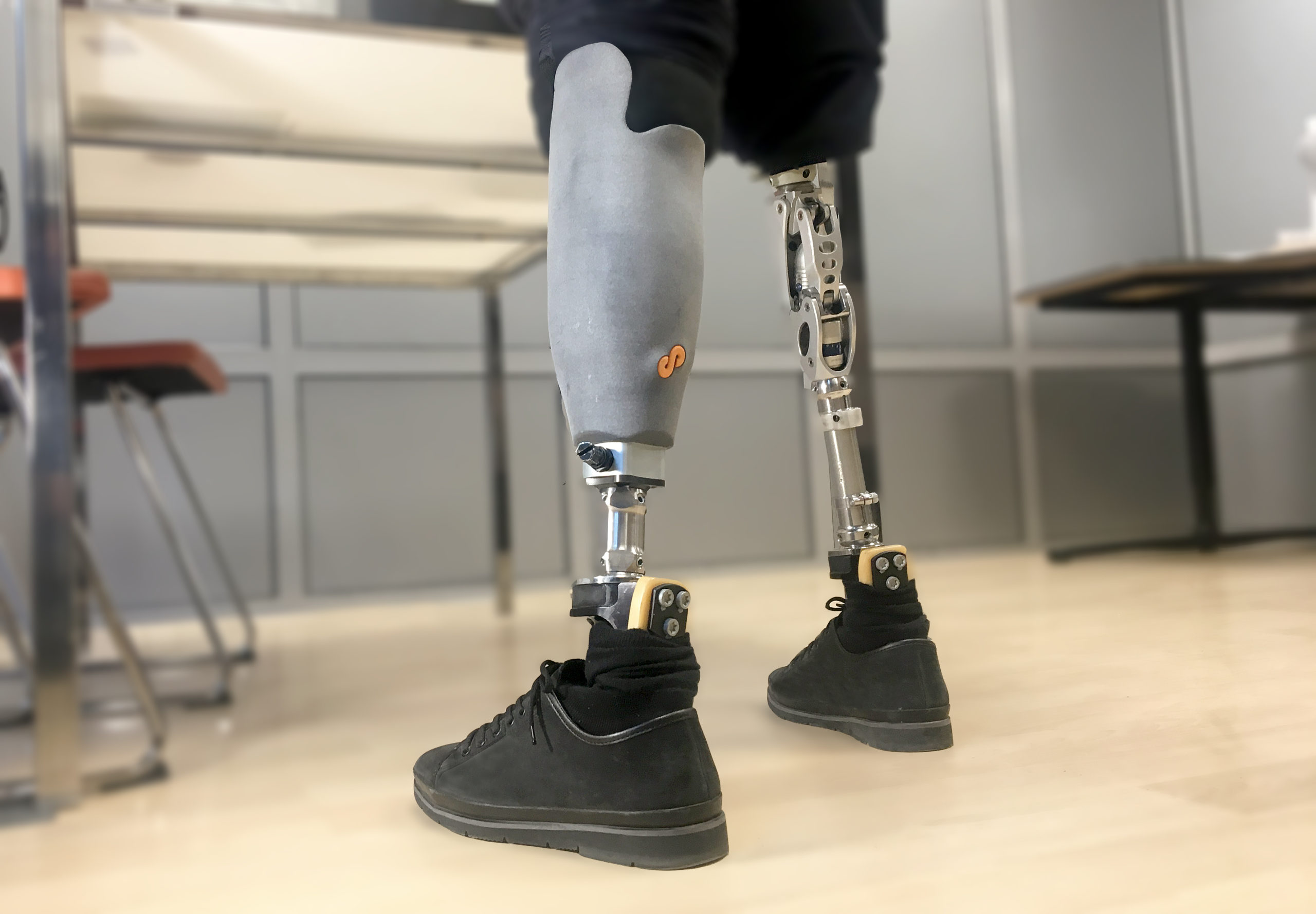 ProsFit: The Startup That Aims To Democratize the Prosthetic Industry