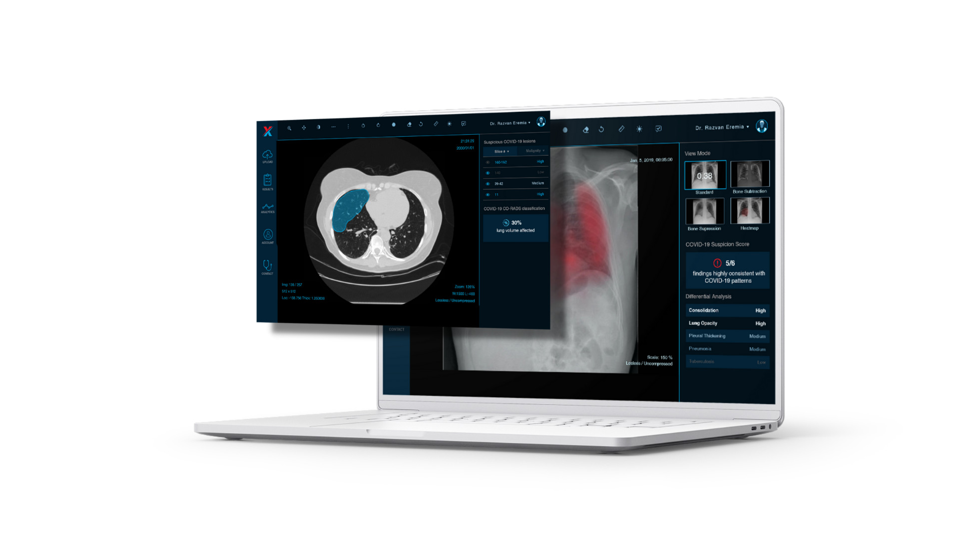 Romanian medtech startup XVision secures €1M in a new funding round